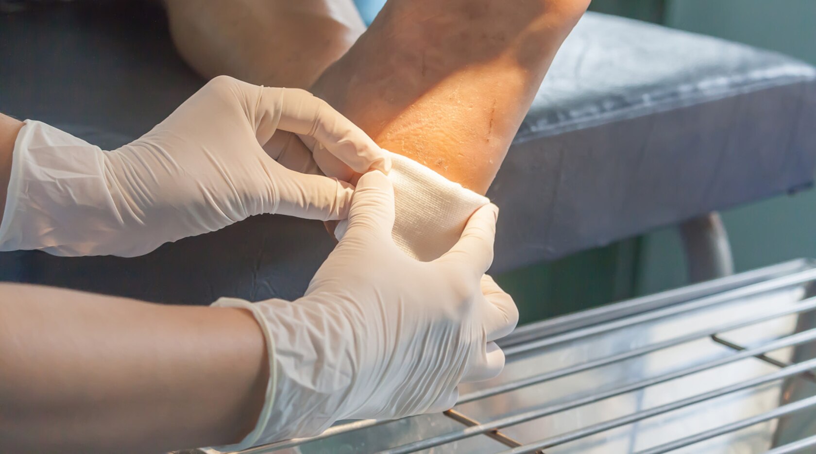 Essity selected to join global task force on prophylactic dressing ...